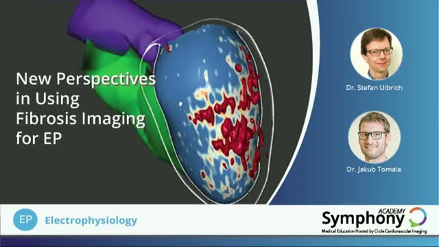 New Perspectives Using Fibrosis Imaging for EP
